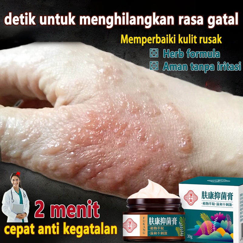 Jual Salep gatal Salep psoriasis Cepat dan efektif Obat Gatal Pantat ...