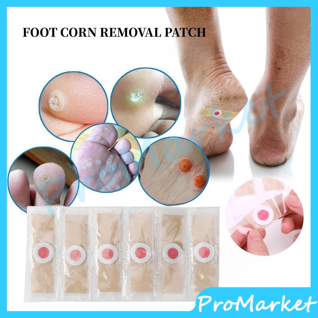 Jual Plester Kutil Medis Penghilang Mata Ikan Kapalan Foot Corn Removal ...