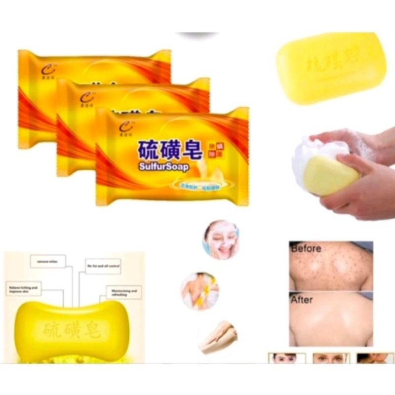 Jual Sabun Mandi Belerang Sulfur Sabun Untuk Kulit Gatal,jamur,Panuan ...