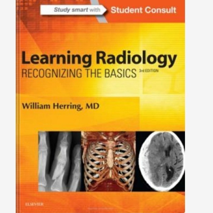 Jual Buku Learning Radiology Recognizing the Basics 3rd Third Edition by Herring JUAL | Shopee ...