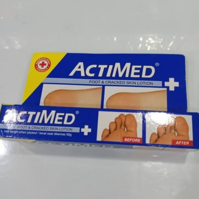 Jual Actimed Foot Cracked Skin Lotion 50 gram | Shopee Indonesia