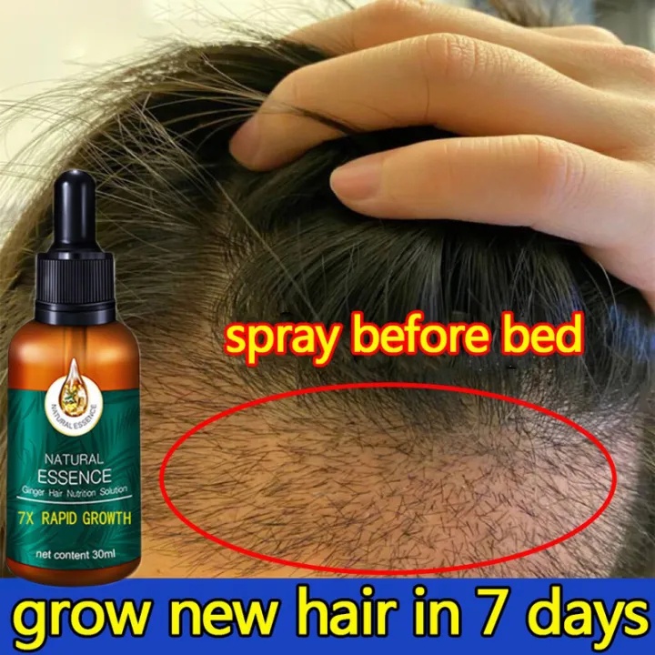 Jual Semprotan Penumbuh Rambut Hair Growth Serum Hair Growth Spray ...