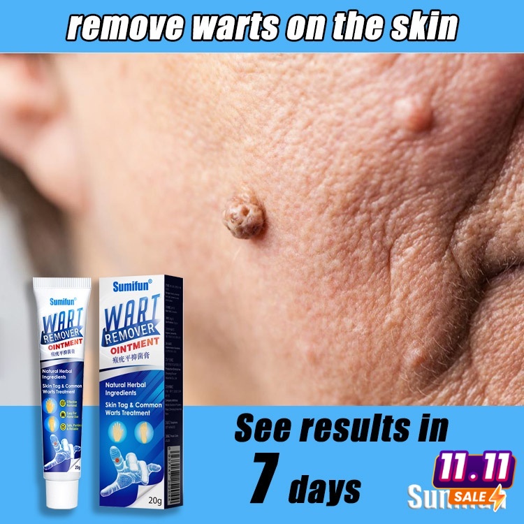 Jual Sumifun Wart Remover & Skin Tag Remover Ointment -Salep Obat ...