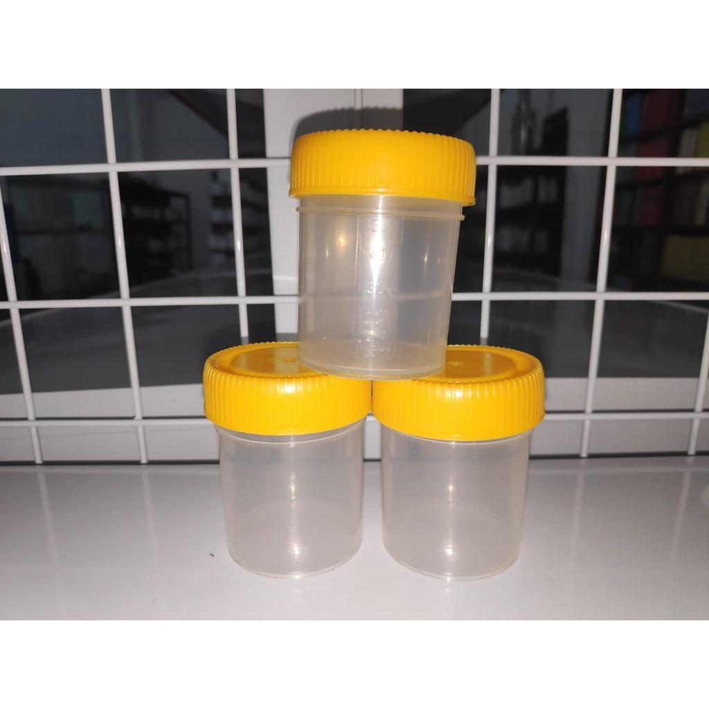 Jual Urine Container Non Steril Tutup Kuning OneMed 60ml | Shopee Indonesia