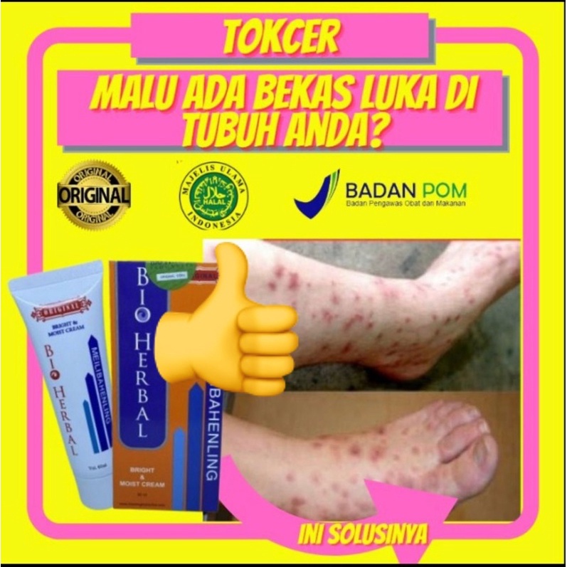 Jual Salep Bio Herbal asli 100 % Original / Salep Penghilang Bekas Luka ...