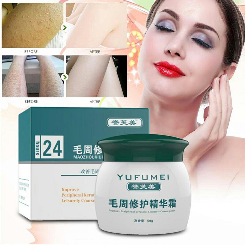 Jual YUFUMEI face body Curing Skin kulit ayam Keratosis Skin Repair ...