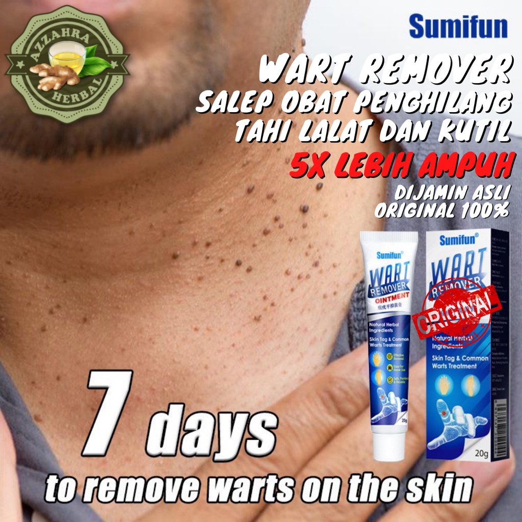 Jual SKIN TAG REMOVER Menghilangkan Kutil Tahi Lalat Mata Ikan ...