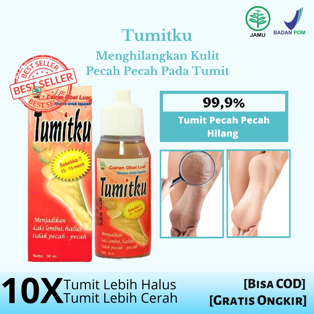 Jual TUMITKU MENGATASI KAKI PECAH KAPALAN DENGAN INSTAN BPOM 30ML ...