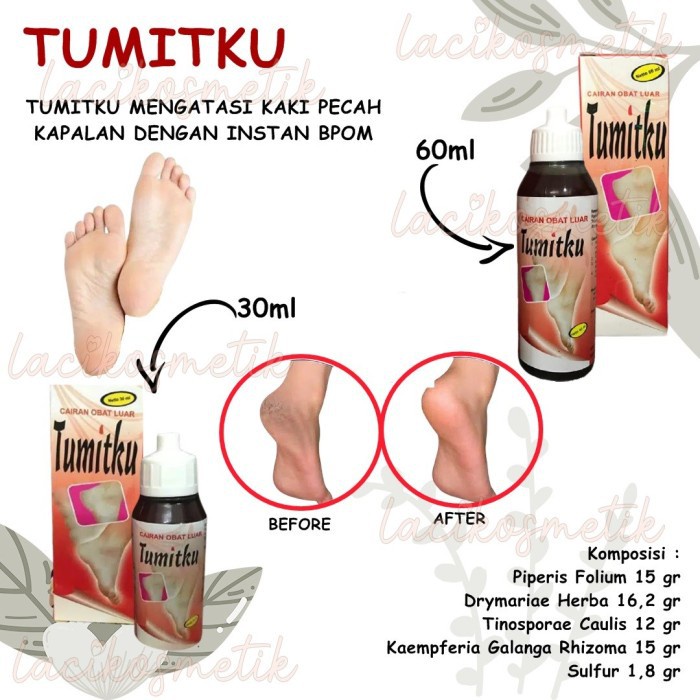 Jual TUMITKU Obat Herbal Mengatasi Kulit pecah-pecah dan kapalan ...