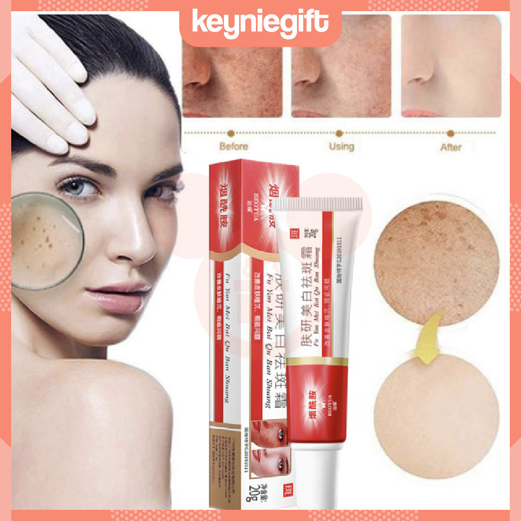 Jual Krim Pemutih Wajah Bintik 7X Niacinamide yang Efektif 100% Asli - Krim Penghilang Flek ...