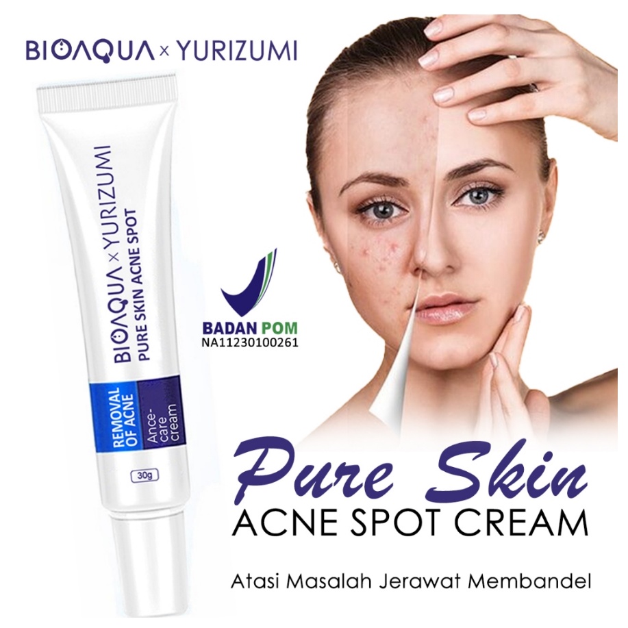 Jual BPOM Pure Skin Acne Spot Bioaqua x Yurizumi Krim Obat Jerawat ...