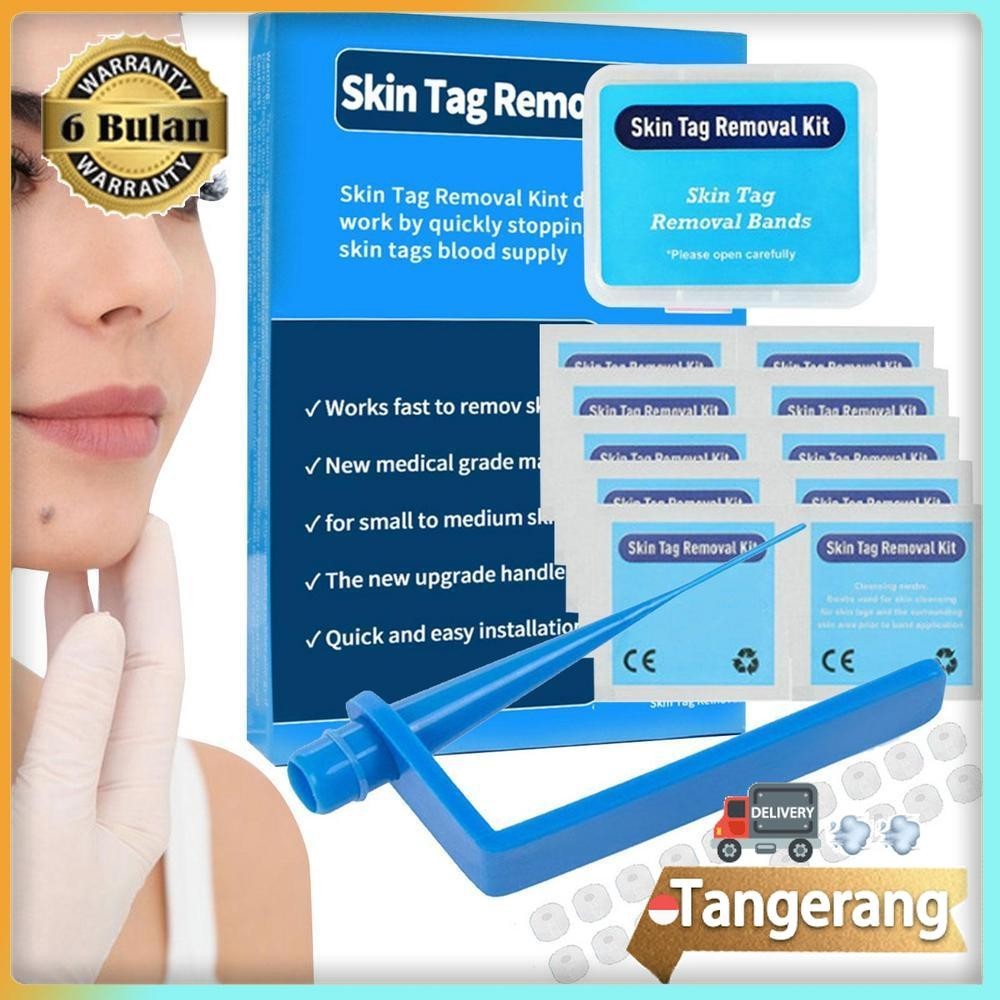 Jual Skin Tag Removal Kit / Skin Tag Remover / Wart Remover / Wart ...