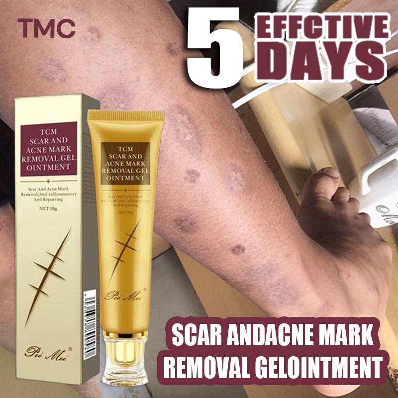 Jual TCM Scar Andacne Mark Removal Gelointment Salep Penghilang Bekas ...