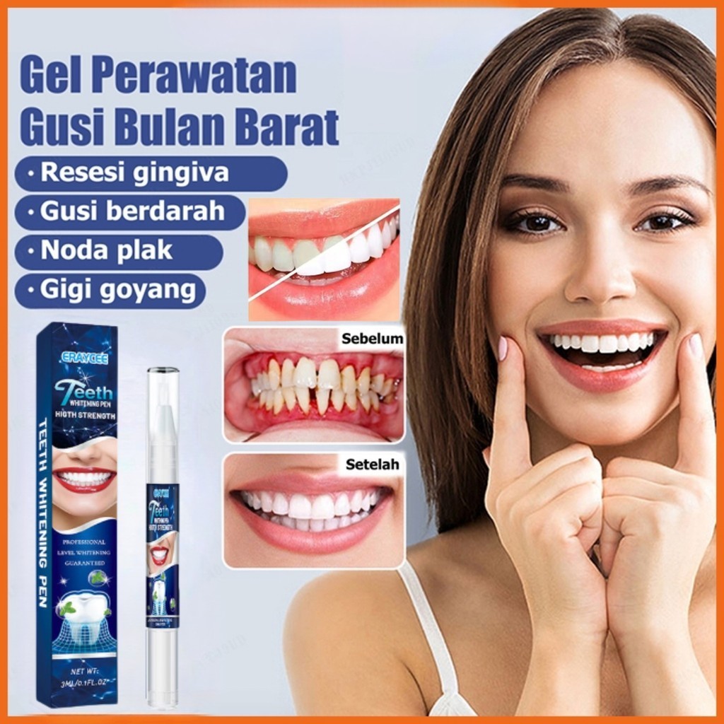 Jual GEL PEMUTIH GIGI AMPUH WHITE PEN pemutih gigi kuning alat pemutih ...