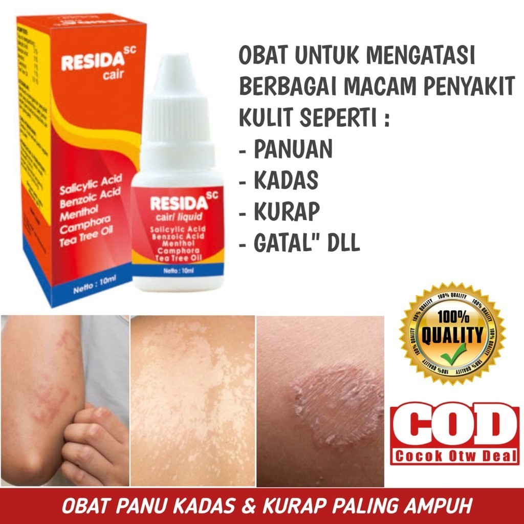 Jual RESIDA CAIR SEBAGAI PENGGANTI KALPANAK CAIR ASLI OBAT KULIT PANU ...
