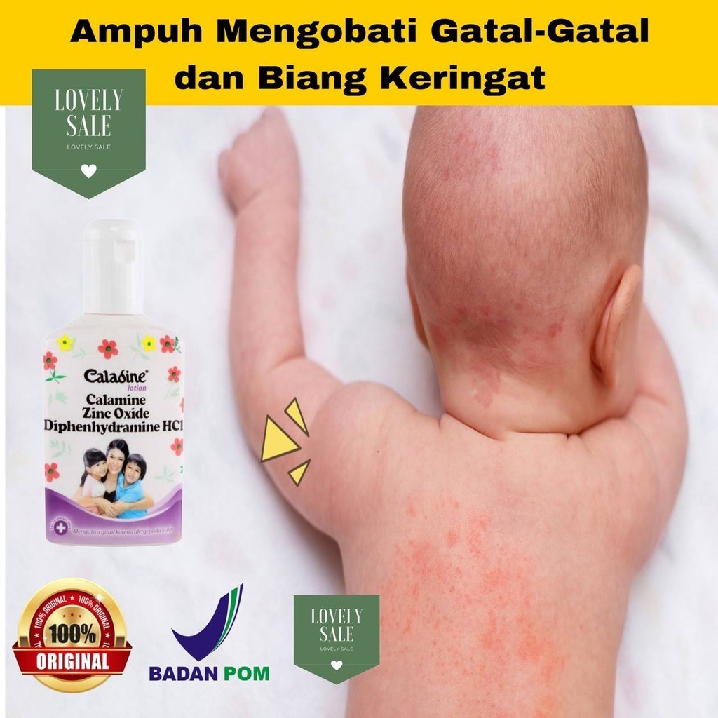 Jual Caladine lotion Calamine Zinc Oxide Diphenhydramine HCI 60ml Obat Gatal Cair BEDAK ...