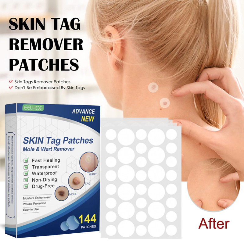 Jual EELHOE 144pcs Stiker Penghilang Kutil Tahi Lalat Wart Removal ...