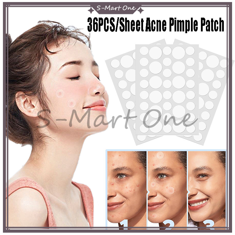 Jual 5pcsX36PCS/Sheet Acne Pimple Patch/Patch Jerawat/Salicylic Acid ...