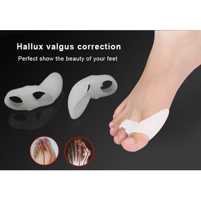 Jual Hallux Valgus Orthotics Sleeve Korektor Tulang Jempol | Shopee ...