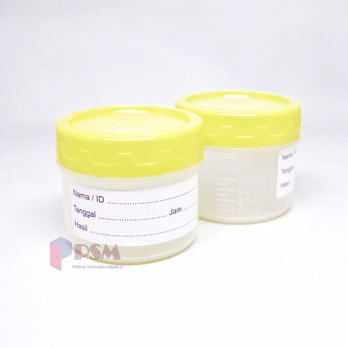 Jual Urine Container Non Steril 60ml / Pot Urin / Sputum Pot | Shopee ...