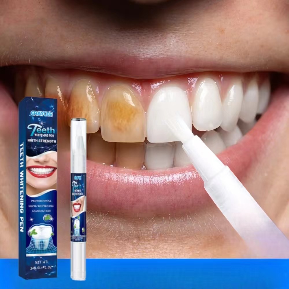 Jual Pena pemutih gigi White Pen Pemutih Gigi Kuning Permanen Instant ...