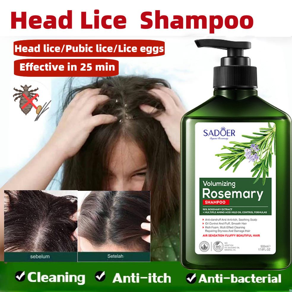 Jual Shampo anti ketombe anti gatal 500ml Pembersihan lembut dan pengontrol minyak Anti ketombe ...