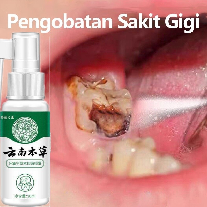 Jual 20ml Semprotan Pereda Nyeri Sakit Gigi Obat Sakit Gigi Berlubang ...