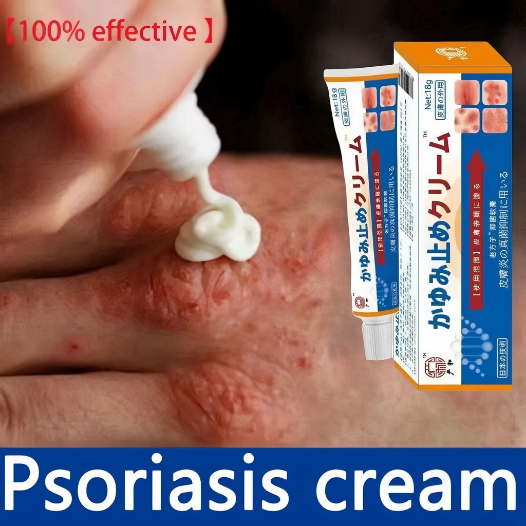 Jual herbal Cina khusus untuk psoriasis membandel, psoriasis, jock itch ...