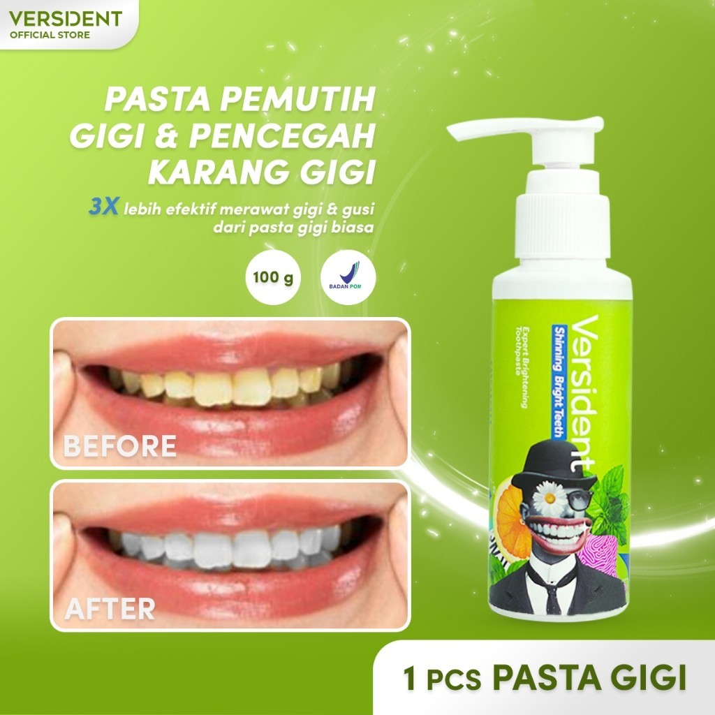 Jual Versident Shinning Bright Teeth | Pasta Gigi Pemutih Gigi ...