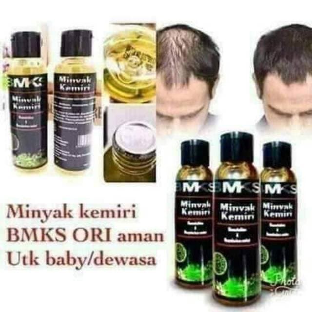 Jual Penumbuh Rambut Pitak Obat Rambut Botak Minyak Kemiri BPOM ...