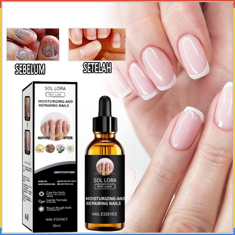 Jual SOLLORA（EELHOE） Nail essence Solusi perbaikan kuku kelabu Obat ...