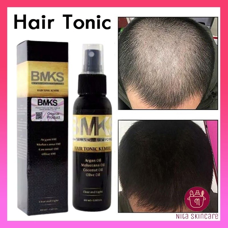Jual Penumbuh Rambut Botak Obat Pelebat Rambut Rontok Penyubur Rambut ...