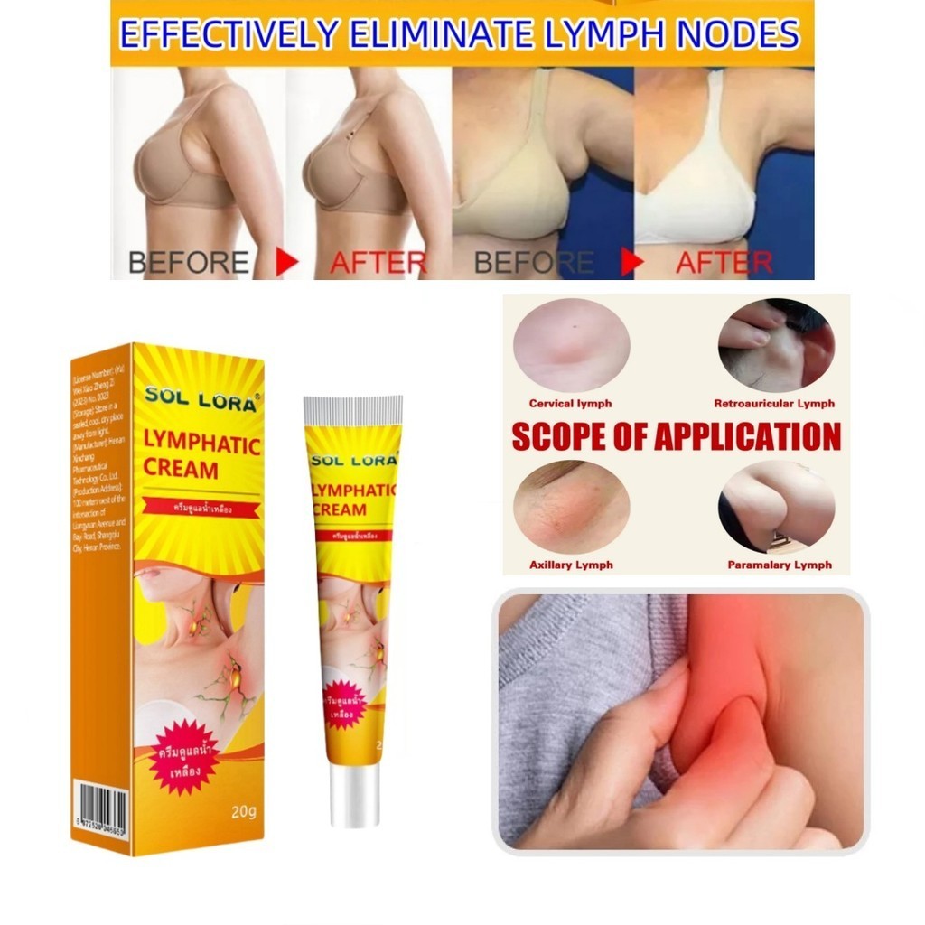 Jual SOL LORA Lymphatic care cream Lymph Care Ointment BUKOL Lymph Node Removal Cream Lipoma ...