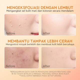 Jual Glad2Glow peeling gel Apricot Glycolic Acid Exfo Smooth Eksfoliasi peeling produk yang ...