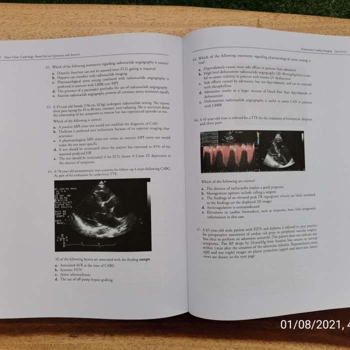 Jual PROMO ~ Buku Kedokteran Mayo Clinic Cardiology - isi Hitam Putih | Shopee Indonesia