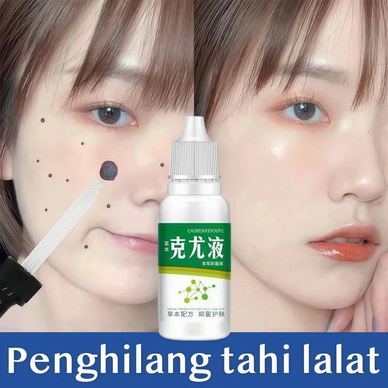 Jual Wart Removal Serum Penghilang Tahi Lalat Penghilang Kutil Skin Tag ...
