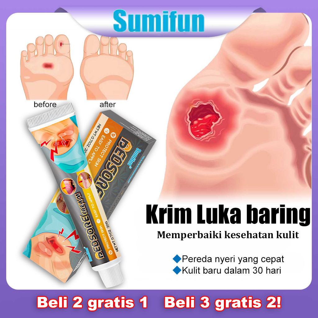 Jual Special offers Krim Luka baring Krim dekubitus Mengobati dekubitus 20g Kaki Diabetik, Luka ...