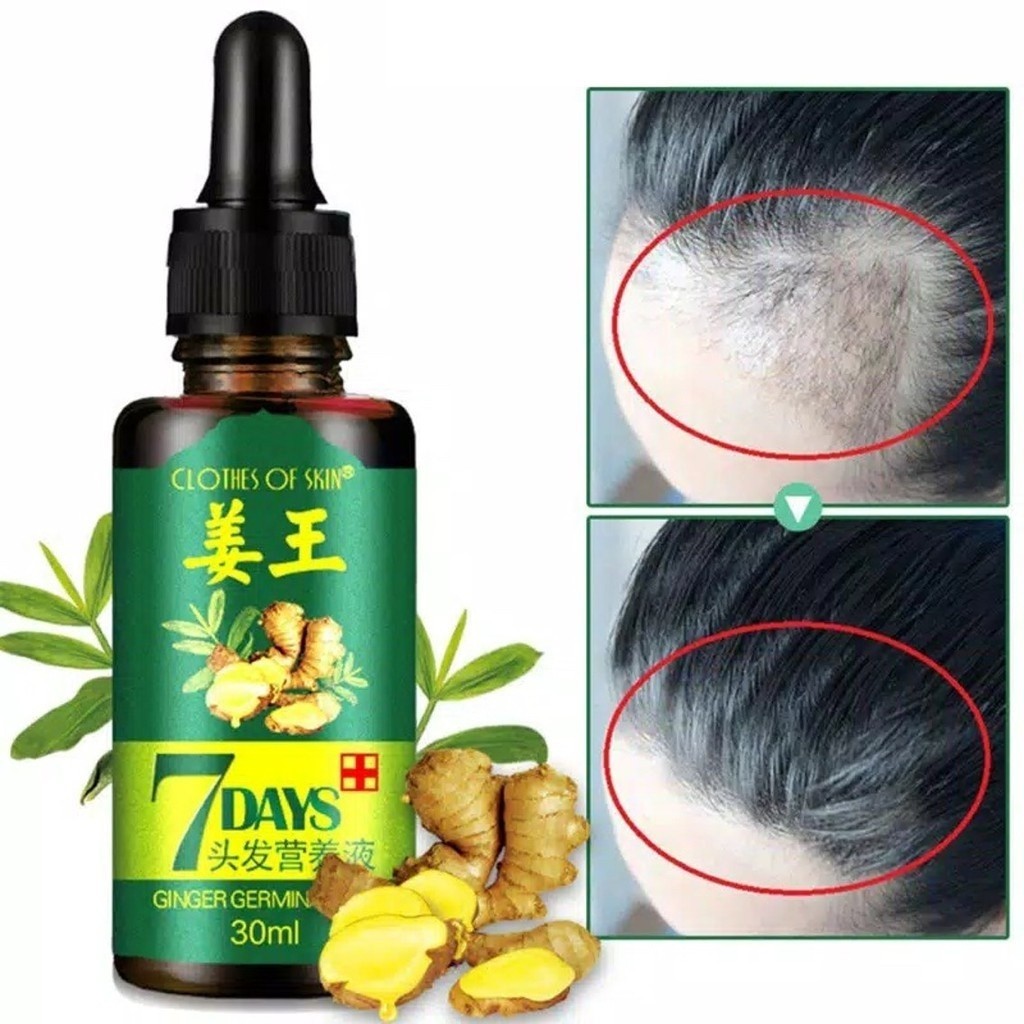 Jual Yurizumi Serum 7 Days Hair Tonic Ginseng Rambut Rontok Ampuh ...