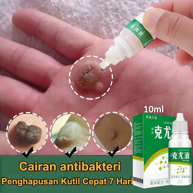 Jual Obat penghilang tahi lalat Mata ikan 10ml Cairan Obat Untuk Kutil ...