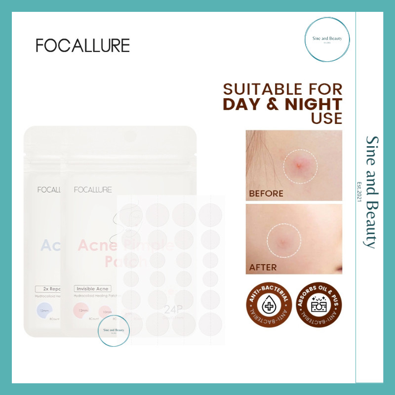 Jual FOCALLURE Spot Patch Acne Treatment Day/Night | Shopee Indonesia