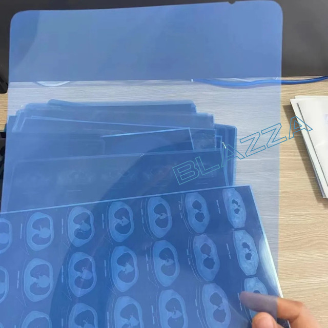 Jual Medical Dry Film Digital Radiology DR CR Rontgen X-Ray Inkjet ...