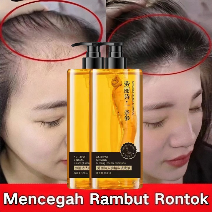 Jual Shampo Penumbuh Rambut Cepat Ginseng Shampoo 300ml pertumbuhan rambut Pengendalian Minyak ...