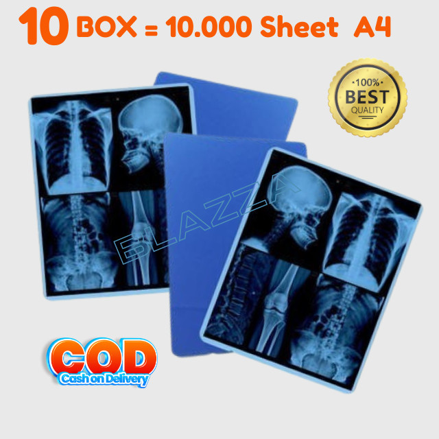 Jual Medical Dry Film Radiology Digital Rontgen X-Ray | Bluebase Inkjet ...