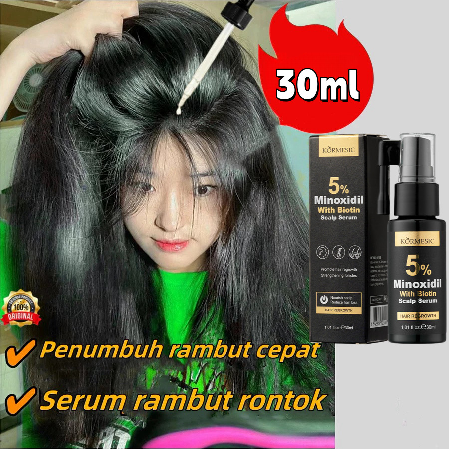 Jual Minoxidil penumbuh rambut serum penumbuh rambut obat rambut rontok ...