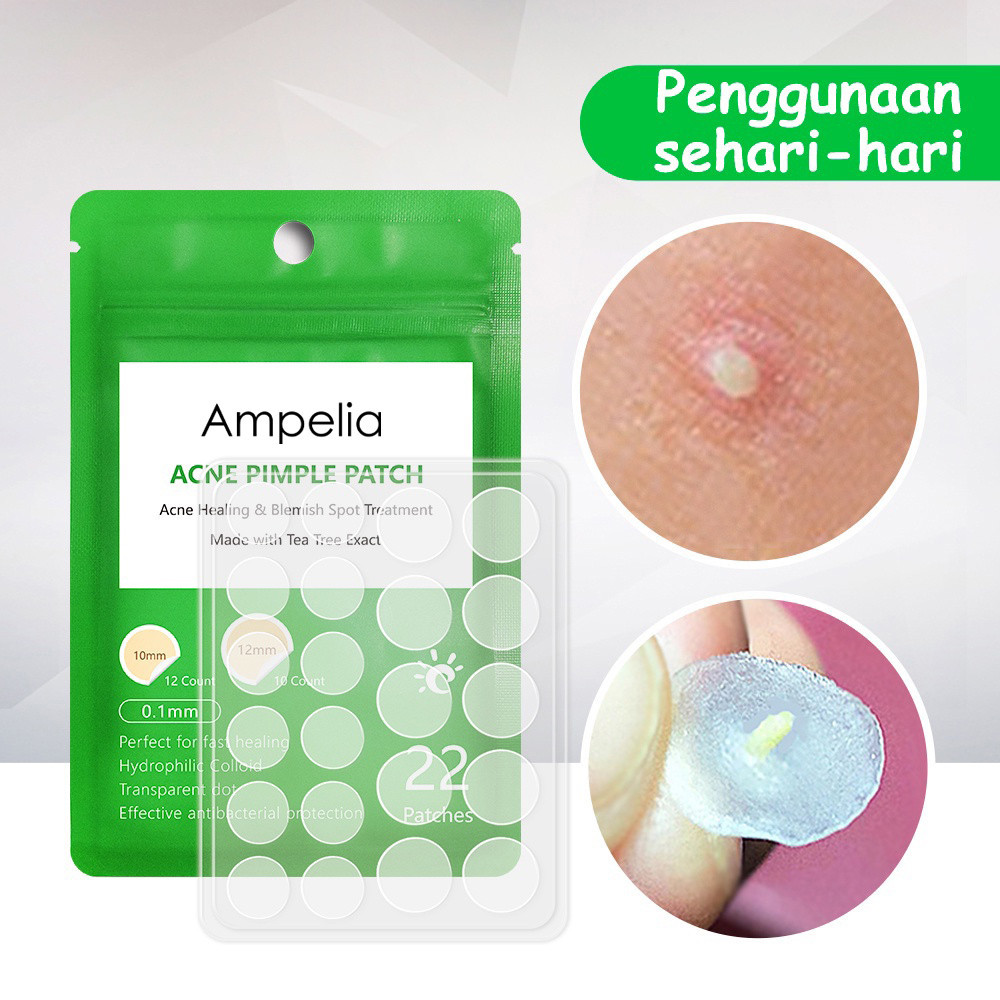 Jual Ampelia Stiker Jerawat / Patch Jerawat / Tempelan Jerawat ...