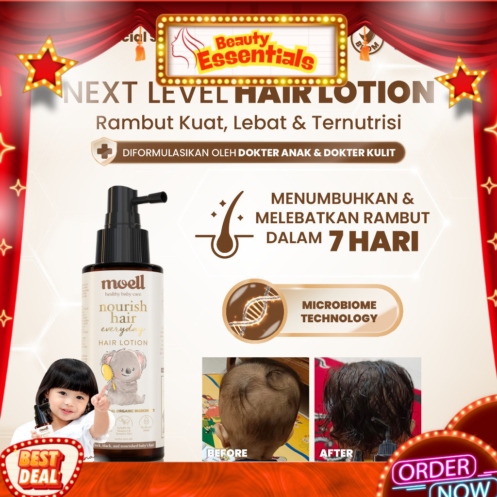 Jual Moell Hair Lotion 100ml Dengan Panax Ginseng, Kemiri, Biotin ...