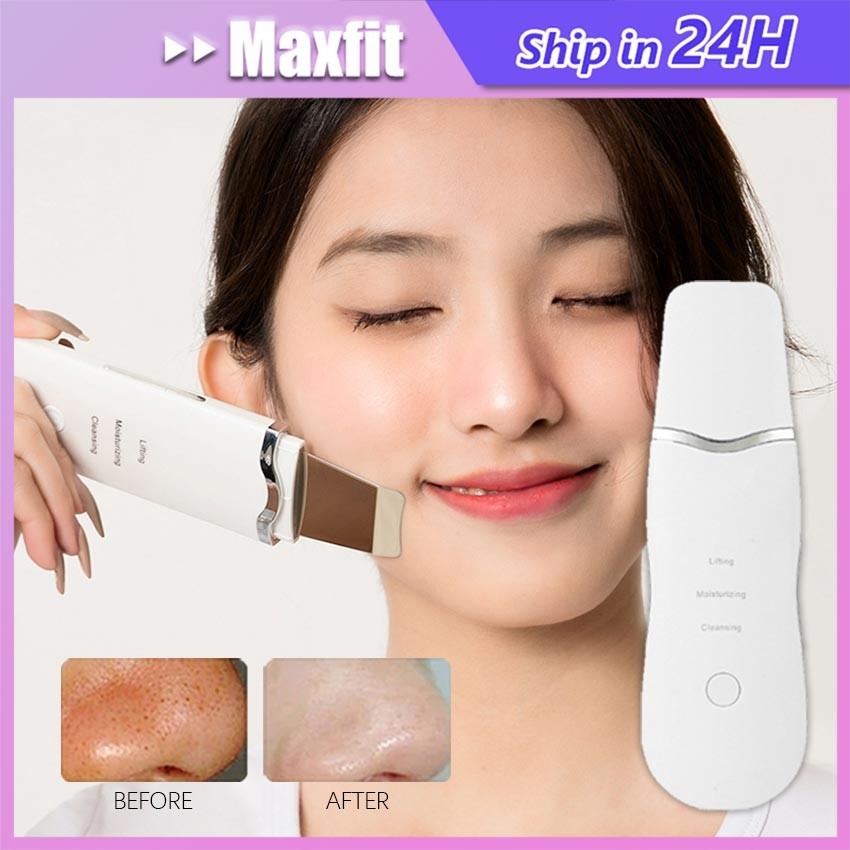 Jual Alat Facial Ultrasonic Skin Scrubber Facial Cleaner Peeling ...