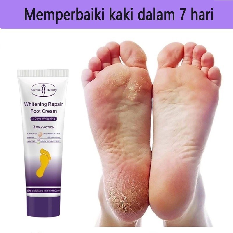 Jual Obat kaki pecah dan kering Foot Cream Tumitku obat kaki pecah 30g ...