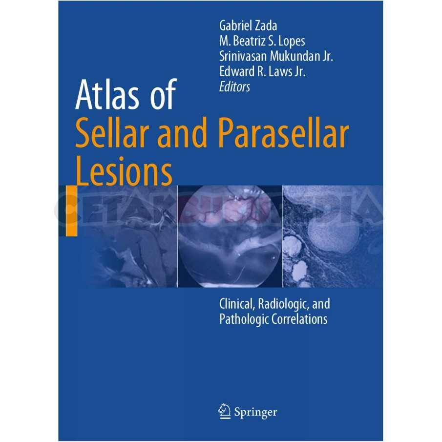Jual Atlas of Sellar Parasellar Lesions Clinical Radiologic Pathol ...