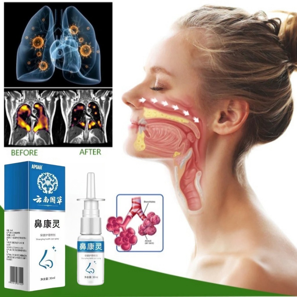 Jual APGRA Nasal Spray Nasal Sprays Obat Sinusitis Polip Hidung ...